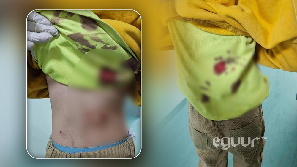 30 97 р сургуулийн сурагчид зодолдох үеэр нэгнээ хайчаар гэмтээжээ